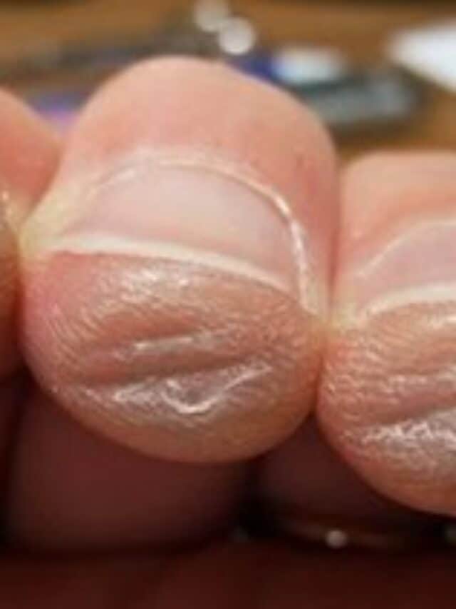 How to Build Guitar Calluses - LedgerNote